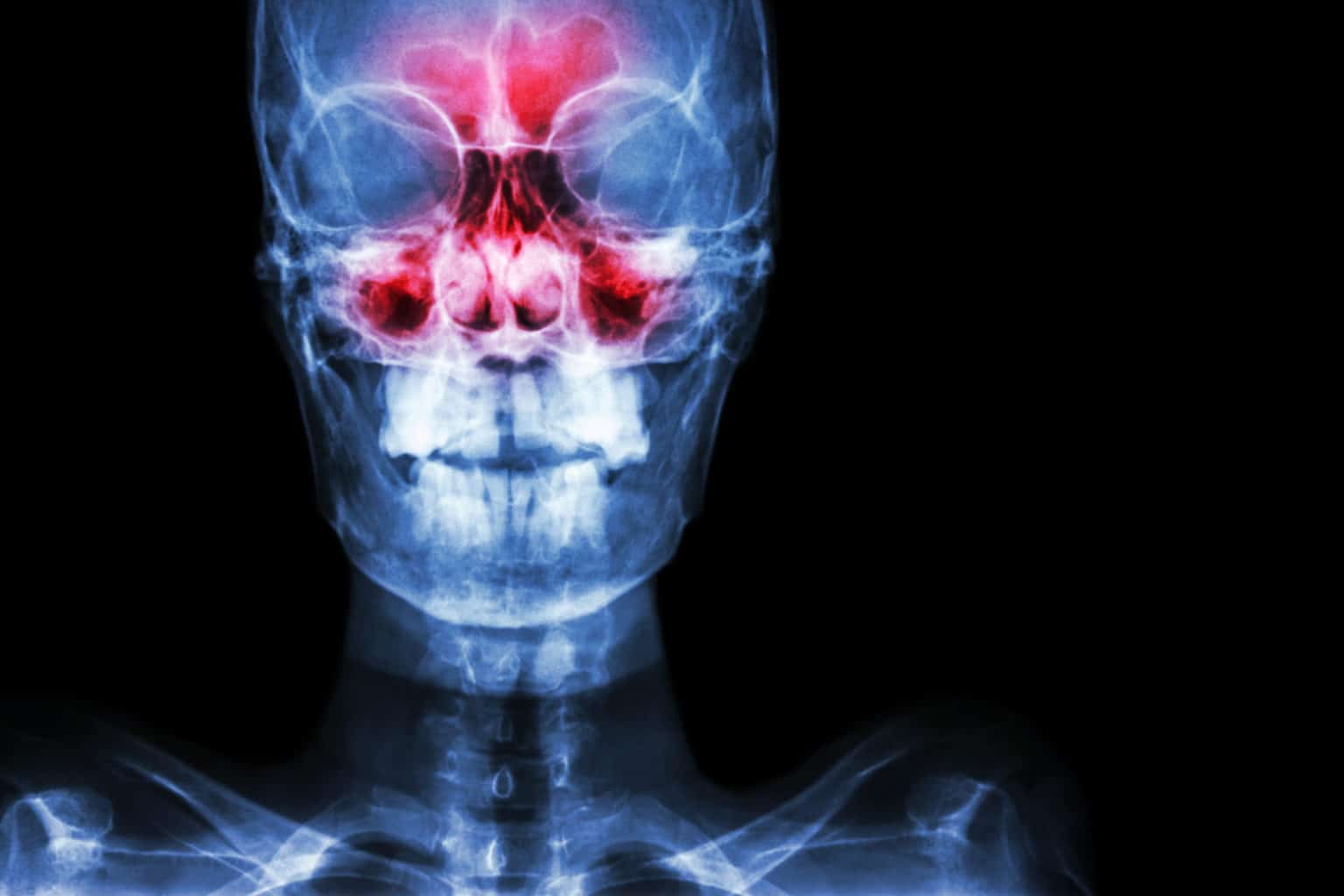 Sinusitis | Advanced Hearing Hawaii